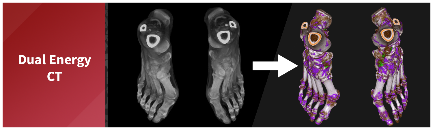 Dual Energy CT – 3D and Quantitative Imaging Laboratory