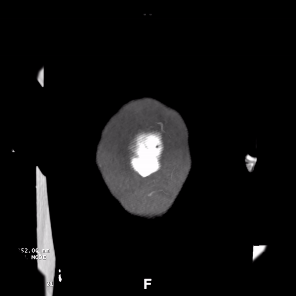 What is a MIP? – 3D and Quantitative Imaging Laboratory
