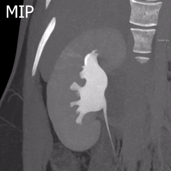 What is a MIP? – 3D and Quantitative Imaging Laboratory