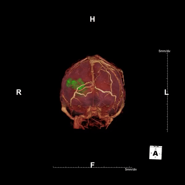 What is Volume Rendering? – 3D and Quantitative Imaging Laboratory