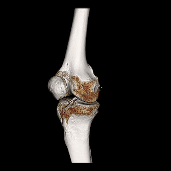What is Volume Rendering? – 3D and Quantitative Imaging Laboratory