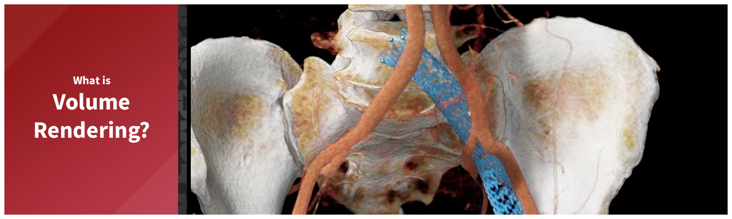 What is Volume Rendering? – 3D and Quantitative Imaging Laboratory