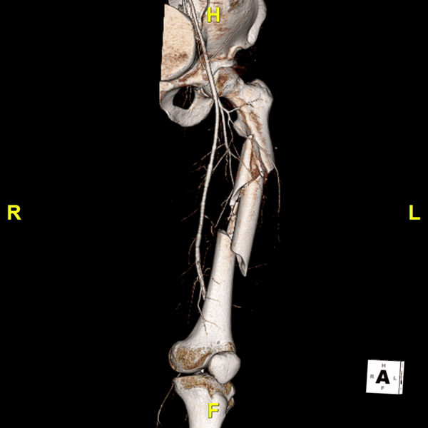 What is Volume Rendering? – 3D and Quantitative Imaging Laboratory