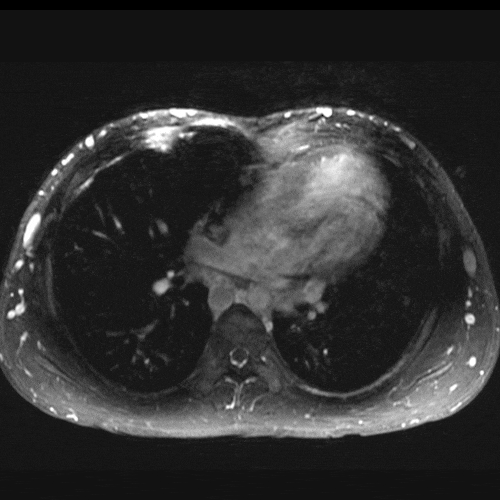 Magnetic Resonance Imaging (MRI) – 3D and Quantitative Imaging Laboratory
