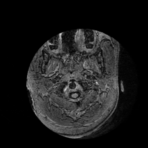 Magnetic Resonance Imaging (MRI) – 3D and Quantitative Imaging Laboratory