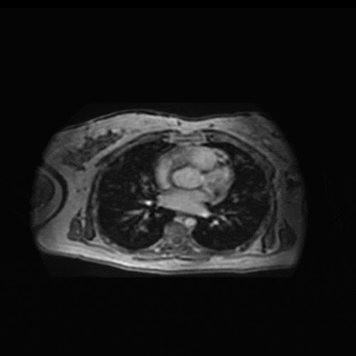 Magnetic Resonance Imaging (MRI) – 3D and Quantitative Imaging Laboratory