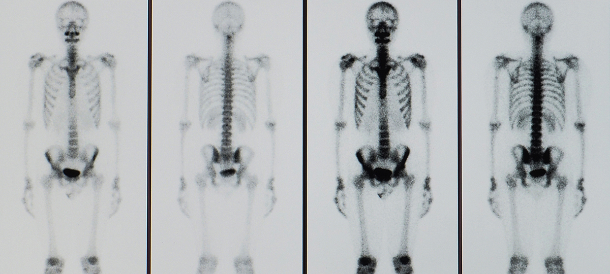 Scintigraphy Allows Doctors To See Changes And Abnormalities Inside Scintigraphy Allows Doctors To See Changes And Abnormalities Inside