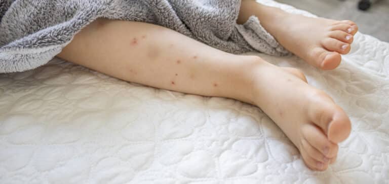 How to Get Rid of Fleas in Your Bed - Hawx Pest Control