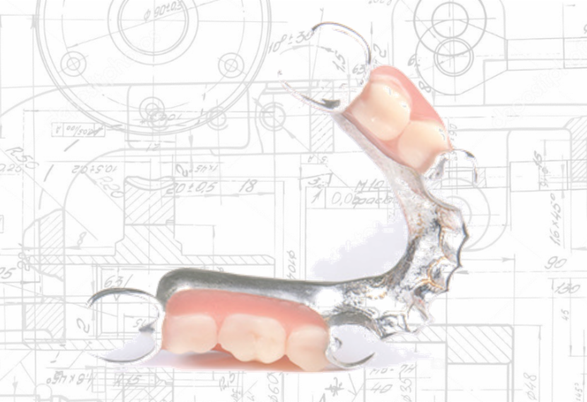 Removable Partial Denture Design