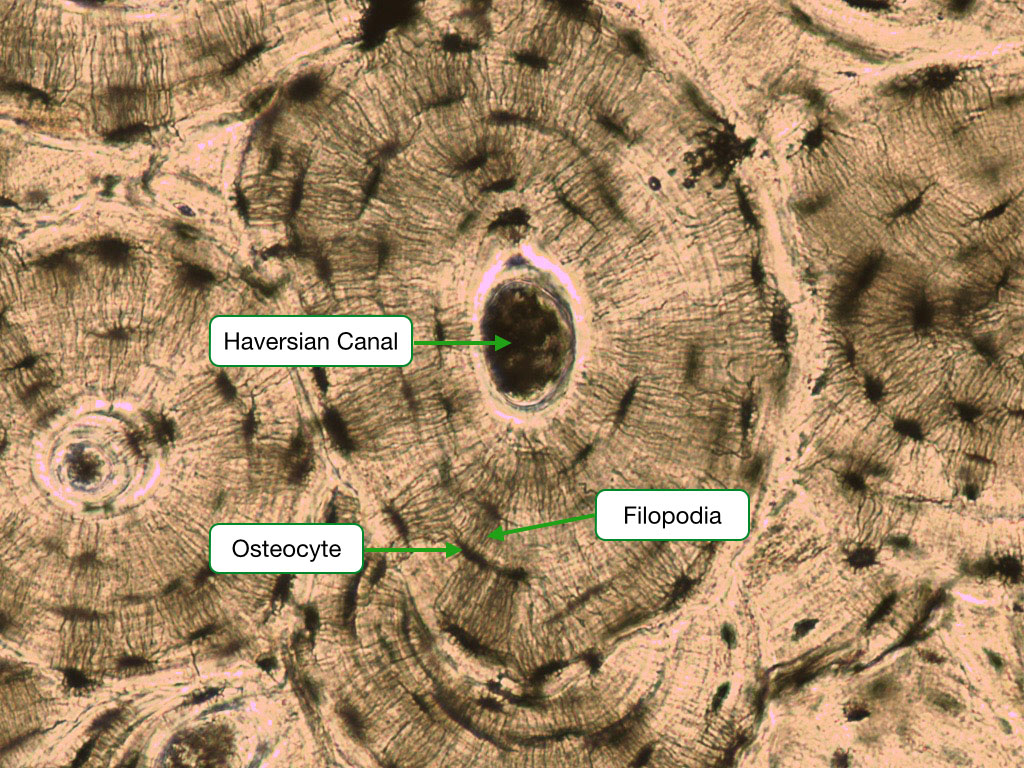 Compact Bone Osteocytes