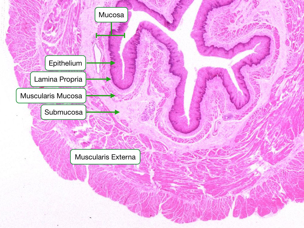 Gastroesophageal Junction Histology Labeled Gastroesophageal Junction Histology Labeled
