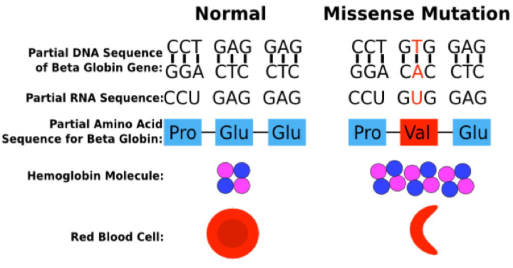 Microangiopathy Sickle Cell Lab Microangiopathy Sickle Cell Lab